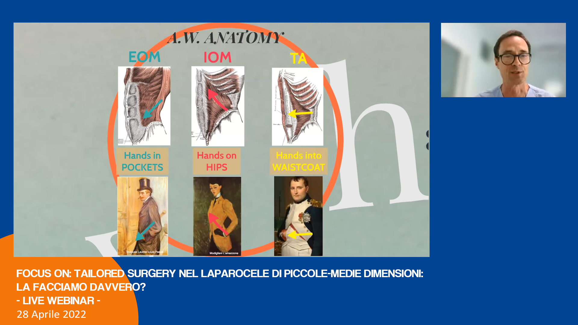 La tecnica Endoscopic Anterior Component Separation | General Surgery ...