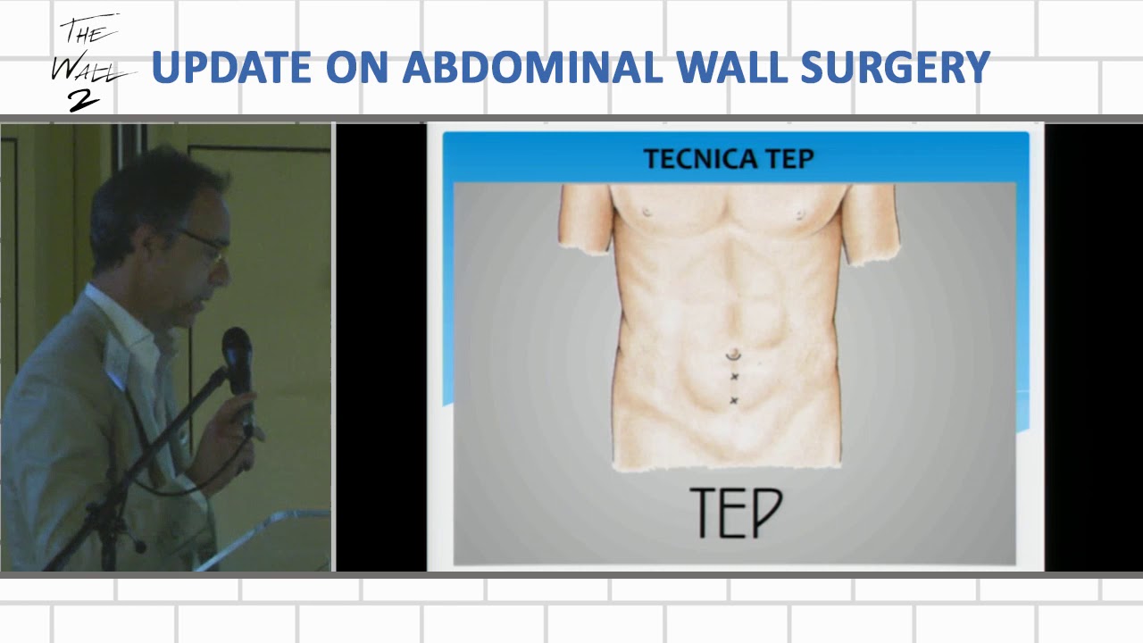 TEP tips & tricks | General Surgery Update