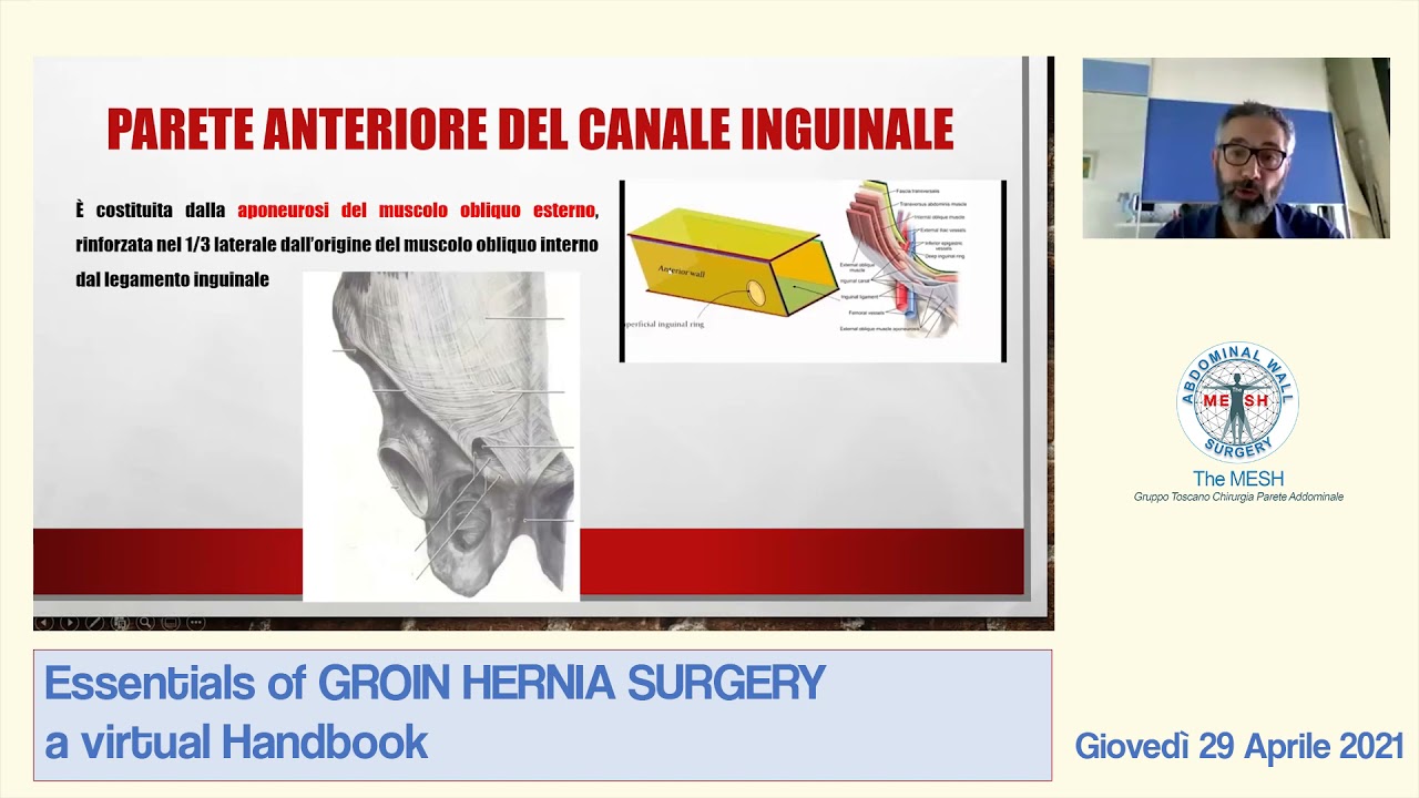 L’anatomia della regione inguinale | General Surgery Update