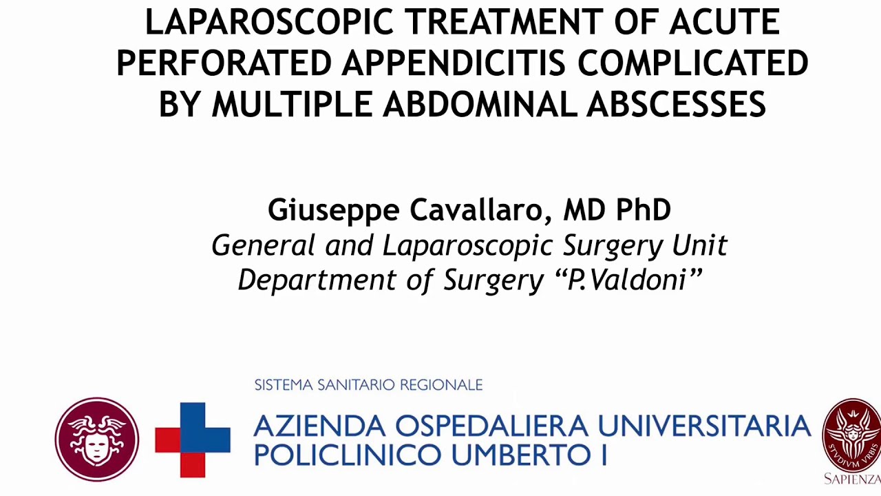 Laparoscopic appendectomy for acute appendicitis with peritonitis and ...