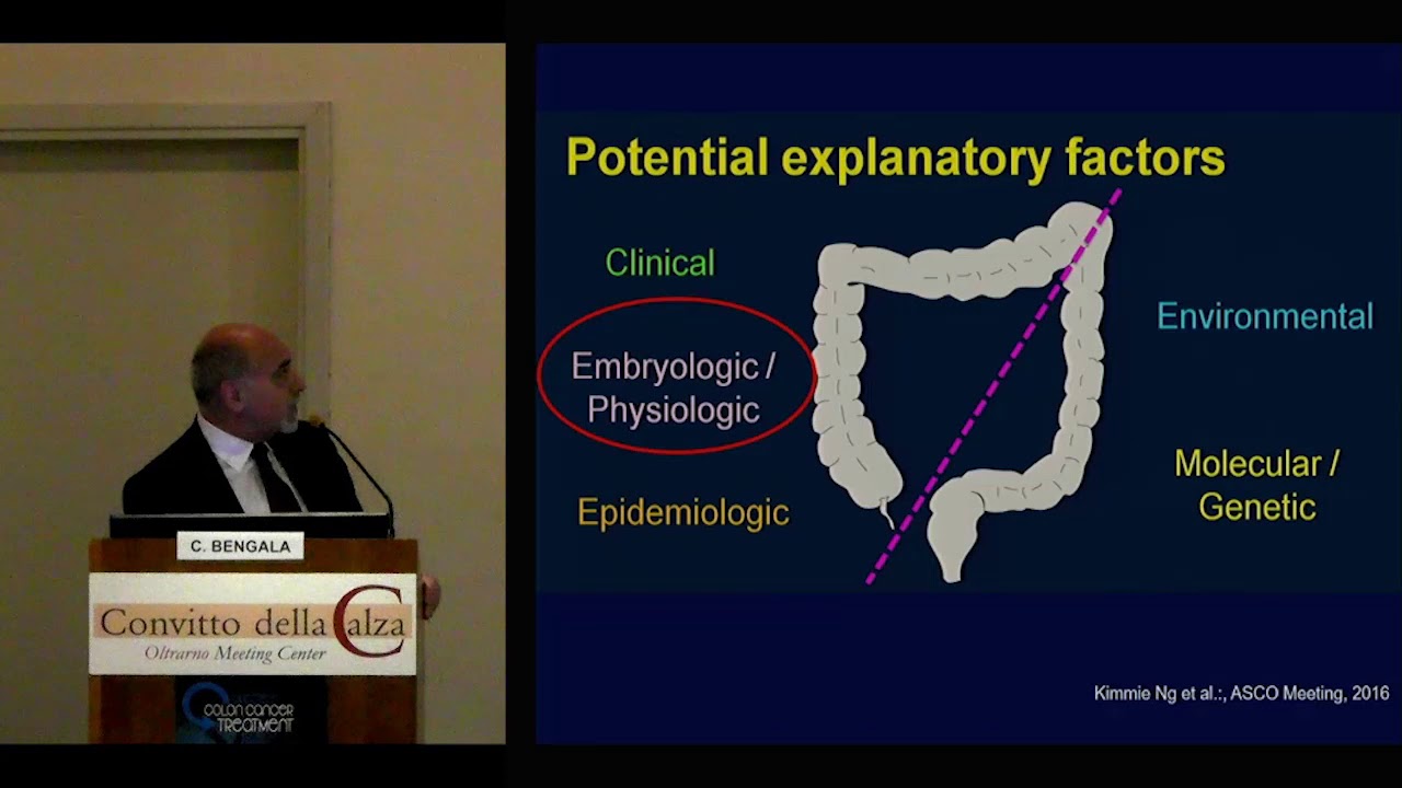Right and left colon cancer. Two different diseases ? | General Surgery ...