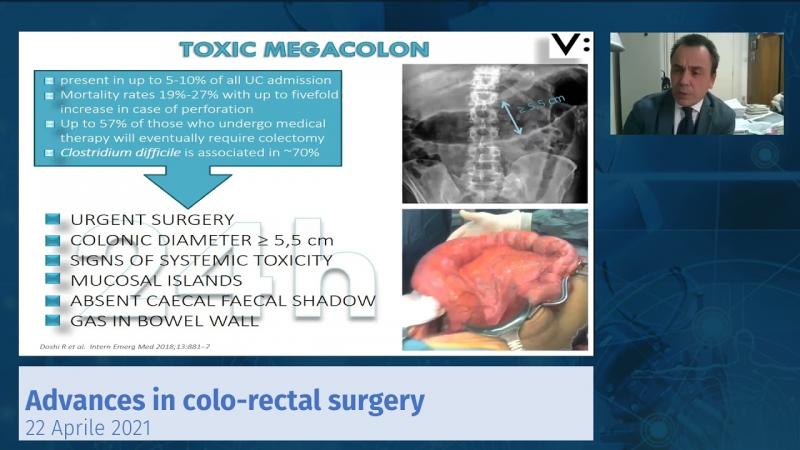 General Surgery Update | Home